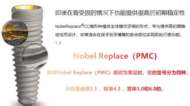 诺贝尔pmc种植体和pcc哪个好，单颗pcc种植牙价格要花多钱,牙齿修复-8682整形网