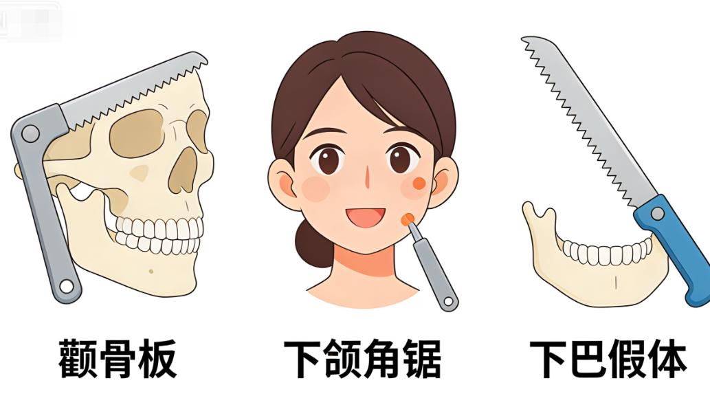 项昌峰有磨骨资质吗？杭州时光有资质，比同院河东镐磨骨病例更全,整形修复-8682整形网